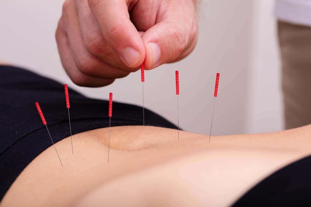 What Not To Do After Acupuncture? | Shanghai Medical Clinic