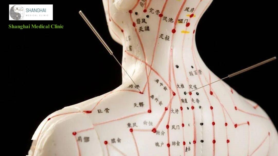 Best Chinese Medicine Therapy For Eczema | Natural & Effective Relief